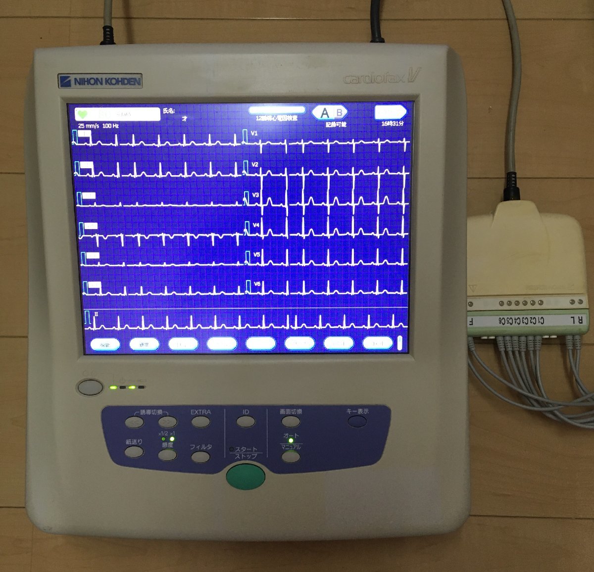 【やや傷や汚れあり】日本光電 心電計 12誘導 測定ケーブル 四肢電極 胸部電極 印刷用紙 nihonkohden 取扱説明書 心電図 病院 医療 動物 検査 臨床 患者 生理の落札情報詳細 ...